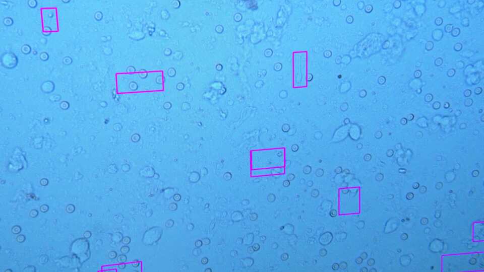 After years of struggling to conceive, Reece and Annabelle may finally ...