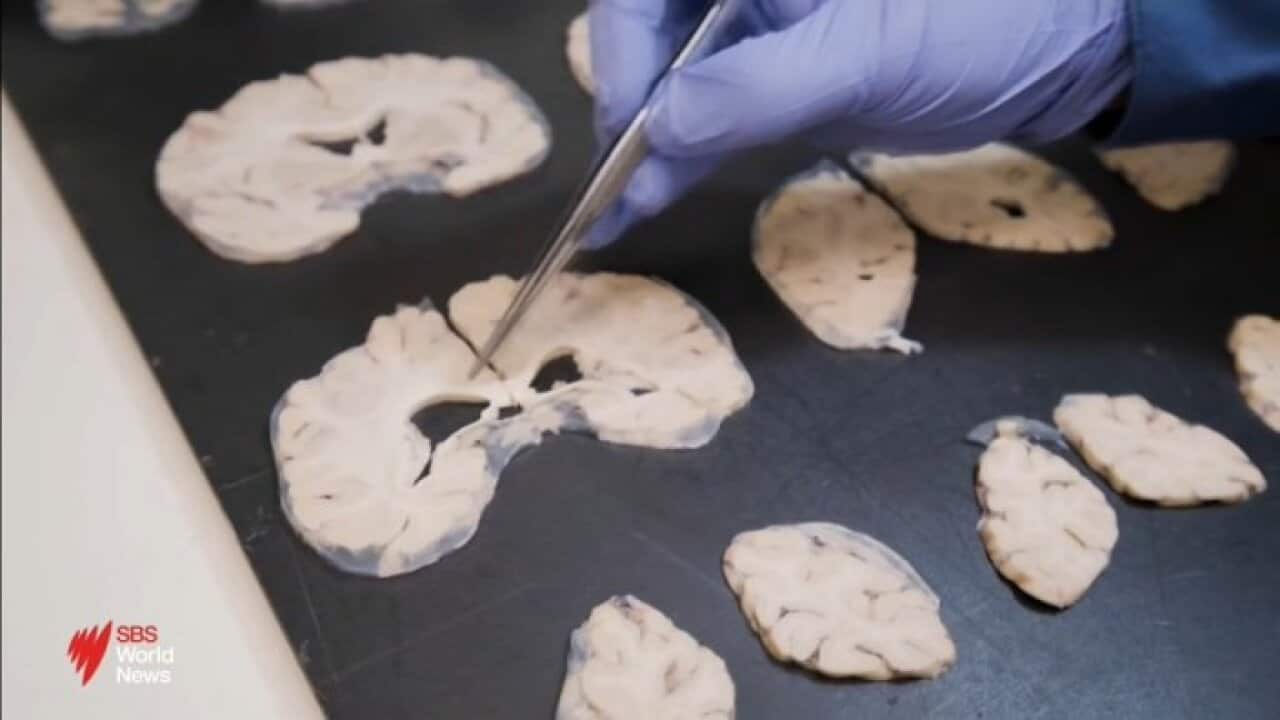 New frontier in neural mapping described as a watershed moment for ...