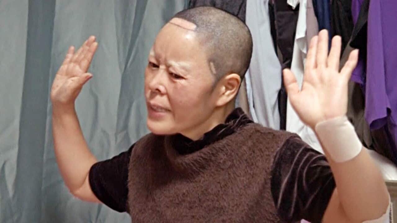 kpop plastic surgery gone wrong