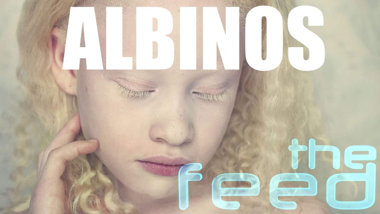 true albinos