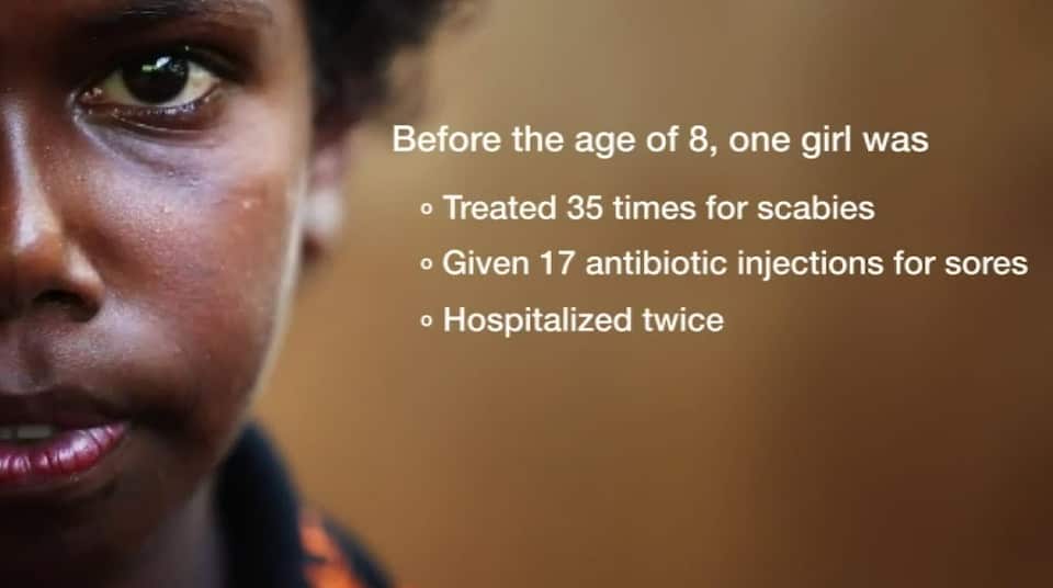 Why the housing shortage exacerbates scabies in Indigenous communities ...