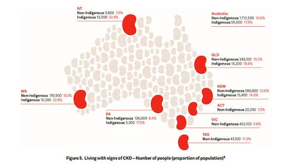 Calls for national taskforce to tackle Indigenous kidney health ‘crisis ...
