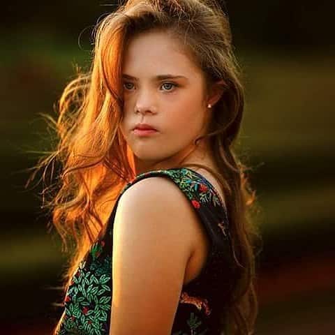 Esta modelo brasileña con síndrome de Down está conquistando corazones ...